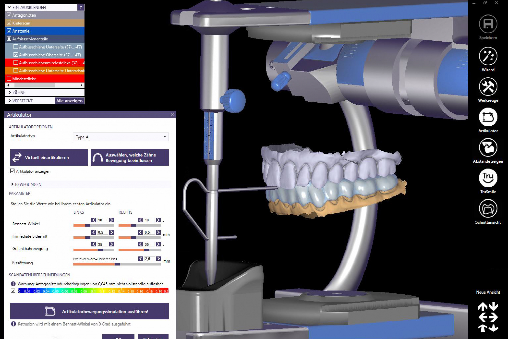 Bite Splint Module - Exsotec®
