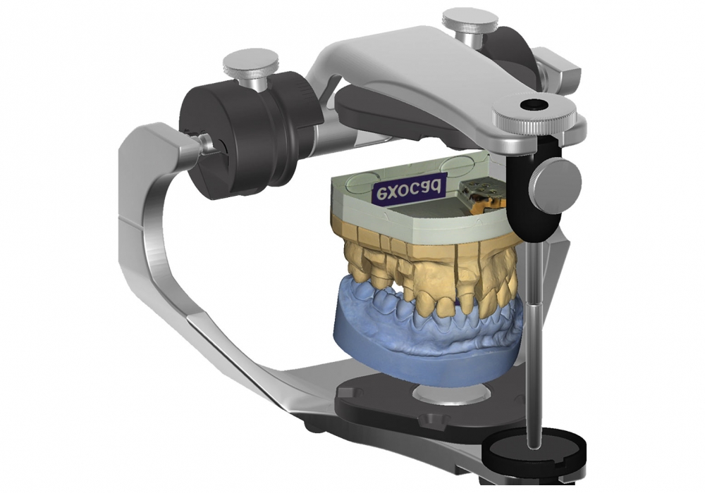 Jaw Motion Import - Exsotec®